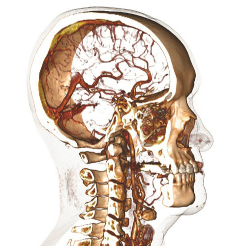 Anatomage - Simulação na saúde