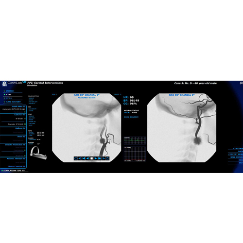 CAE CathLabVR simulador cardíaco - Simulação na saúde