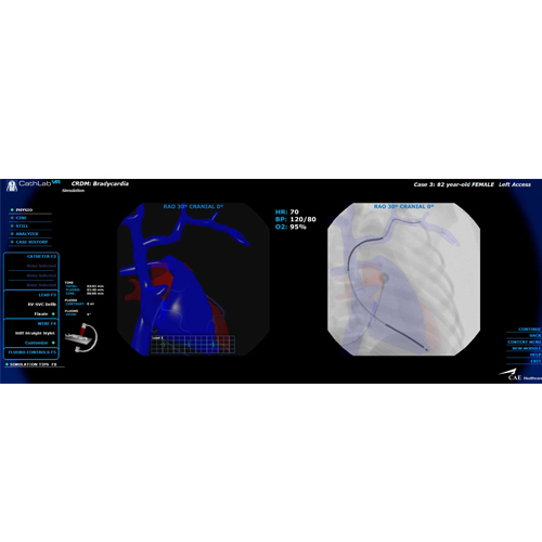 CAE CathLabVR simulador cardíaco - Simulação na saúde