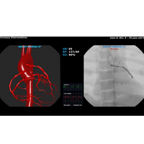 CAE CathLabVR simulador cardíaco - Simulação na saúde