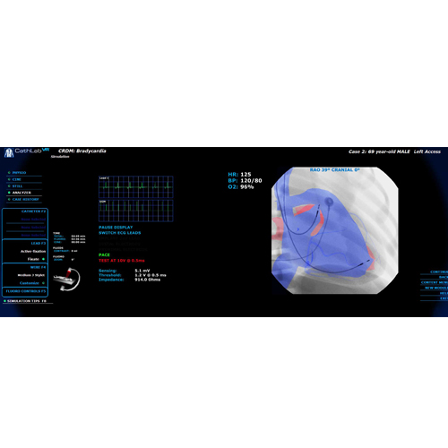 CAE CathLabVR simulador cardíaco - Simulação na saúde