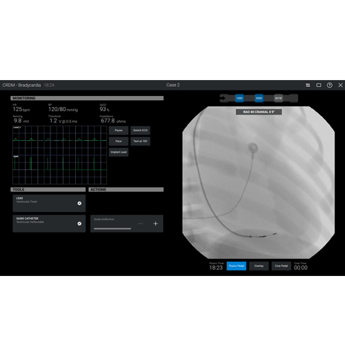 CAE CathLabVR simulador cardíaco - Simulação na saúde