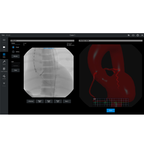 CAE CathLabVR simulador cardíaco - Simulação na saúde