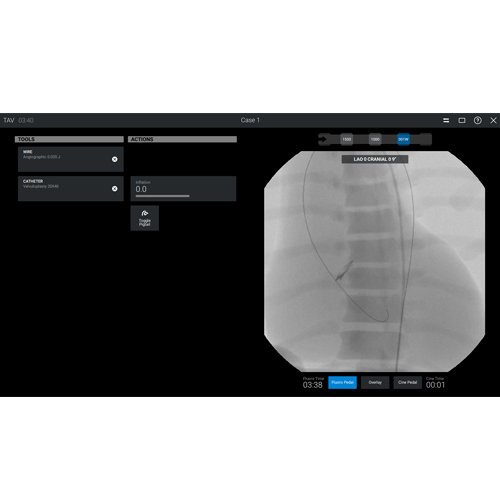 CAE CathLabVR simulador cardíaco - Simulação na saúde