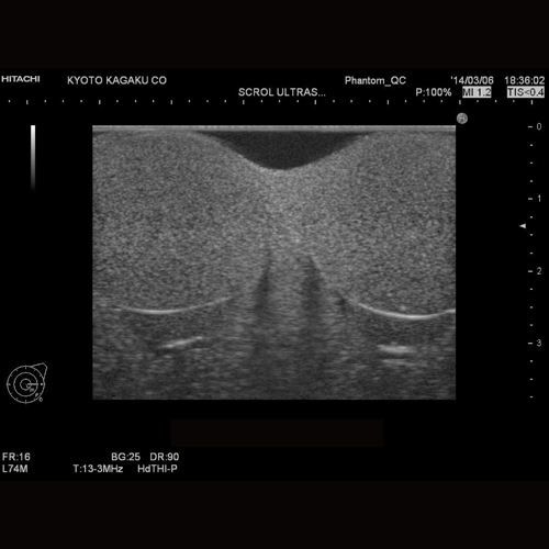 Ultrassom da região escrotal (testículos) - Simulação na saúde