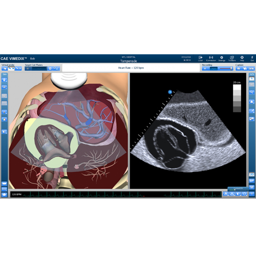 VIMEDIX ecocardiografia transtorácica, transesofágica - Simulação na saúde
