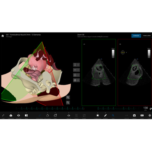 Vimedix simulador Ob-Gyn treinamento de ultrassom - Simulação na saúde