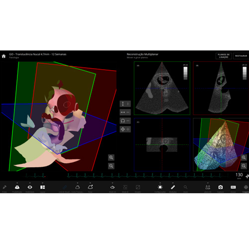 Vimedix simulador Ob-Gyn treinamento de ultrassom - Simulação na saúde