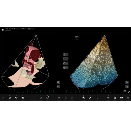 Vimedix simulador Ob-Gyn treinamento de ultrassom - Simulação na saúde