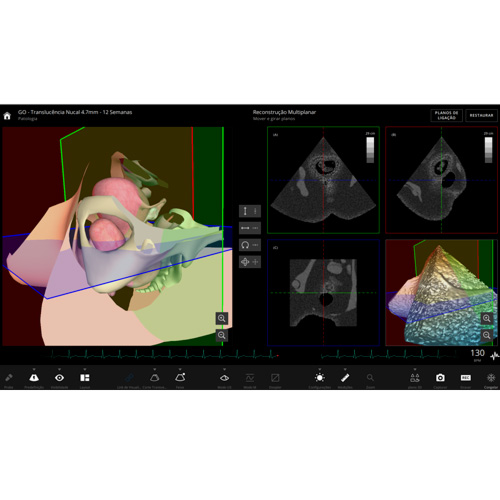 Vimedix simulador Ob-Gyn treinamento de ultrassom - Simulação na saúde