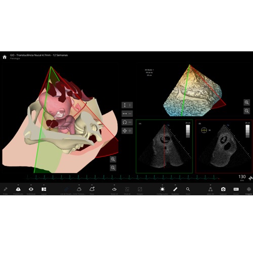 Vimedix simulador Ob-Gyn treinamento de ultrassom - Simulação na saúde