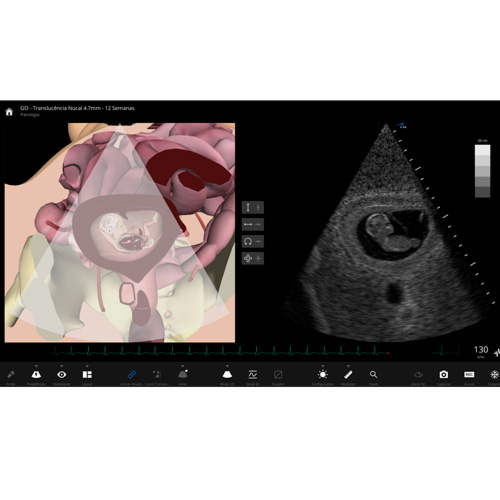 Vimedix simulador Ob-Gyn treinamento de ultrassom - Simulação na saúde