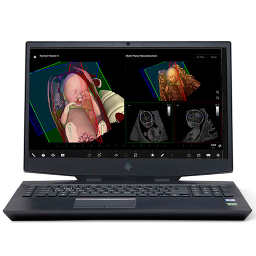 Vimedix simulador Ob-Gyn treinamento de ultrassom - Simulação na saúde