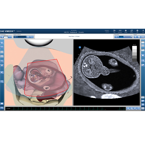 Vimedix simulador Ob-Gyn treinamento de ultrassom - Simulação na saúde