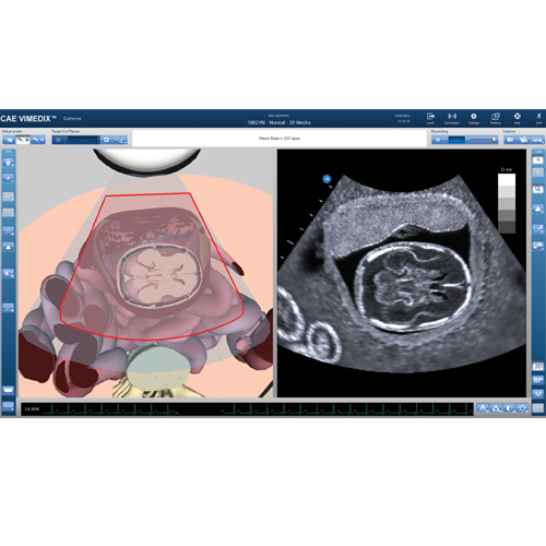 Vimedix simulador Ob-Gyn treinamento de ultrassom - Simulação na saúde