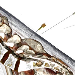 Anatomage - Simulação na saúde